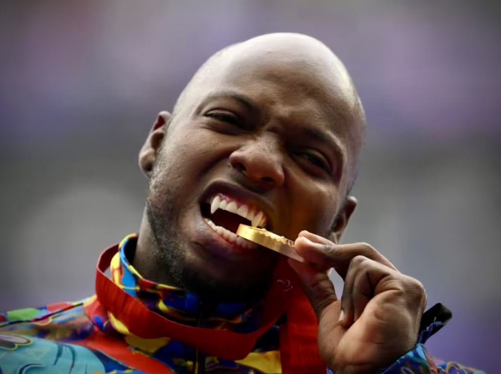 ¿Por qué Mauricio Valencia tiene “colmillos de vampiro”? Respuesta del ...